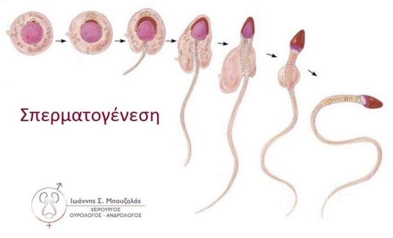 Σπερματοζωάρια - Ιωάννης Μπουζαλάς Χειρουργός Ουρολόγος